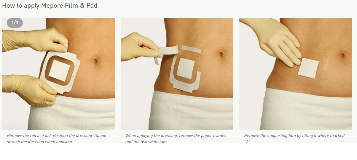 Mepore Film & Pad | British Chemist